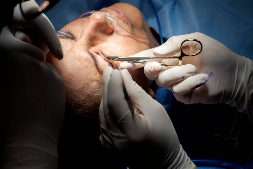 Anesthesia for Eyelid Surgery - DFW Anesthesia Professionals